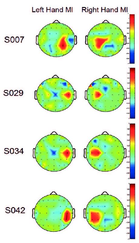 Visualization Of Regularized Filter Bank Common Spatial Patterns In Download Scientific Diagram