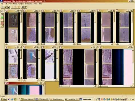 Example Of A Parallel Processing By Image Region Implementation In