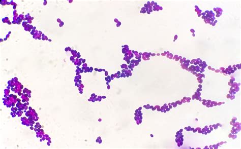 Premium Photo Candida Colony Under Microscopic View Or Candida
