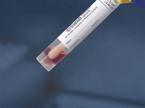 How To Do A Mrsa Nasal Swab Informacionpublicasvetgobgt