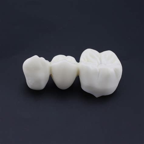 Removable Dental Implants