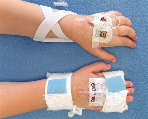 Peripheral Intravenous Cannulae In Neonates To Splint Or 54 Off