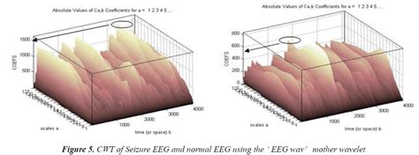 Seizure Detection By Classification Of Eeg Signals Based On Dwt