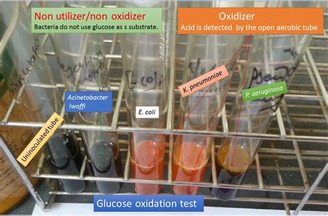 Oxidation Fermentation Test