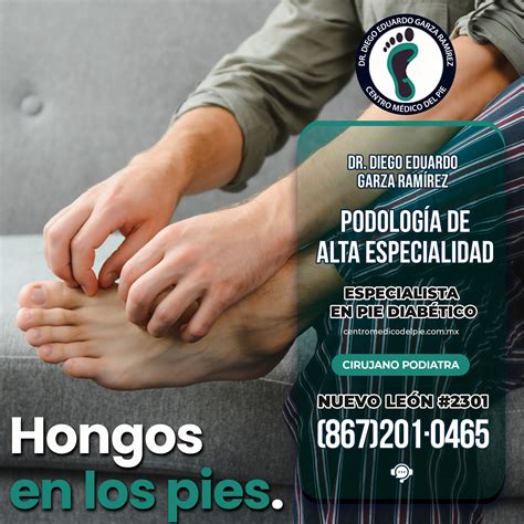 Los Hongos En Los Pies También Se Centro Médico Del Pie