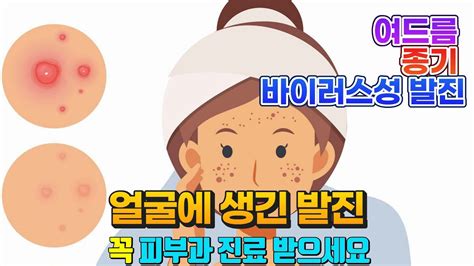 얼굴에 생긴 발진 세가지 여드름 종기 바이러스성발진 피부과진료를 통해서 진단받고 치료하자 Youtube