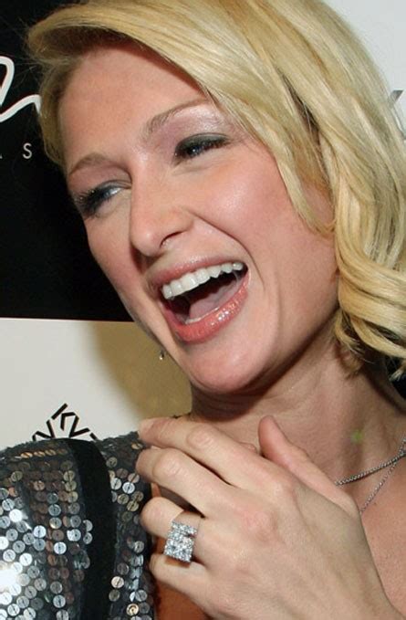 Paris Hilton Tongue Superficial Gallery