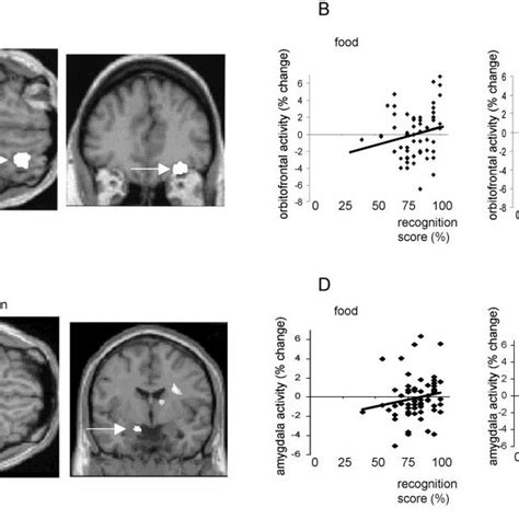 A An Spm Showing An Activation In Right Orbitofrontal Cortex That