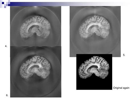 Ppt Image Reconstruction From Projections Powerpoint Presentation