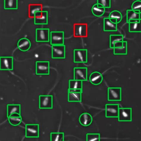 Sperm Analysis Technologies Home