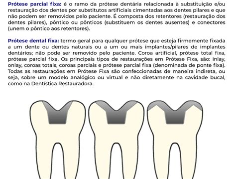 Protese Fixa El Treinador Curso Hotmart