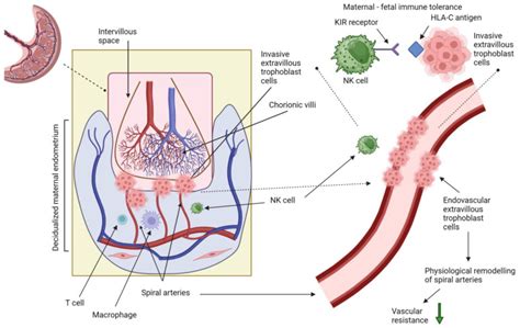Pathophysiology Of Pre Eclampsia—two Theories Of The Development Of The