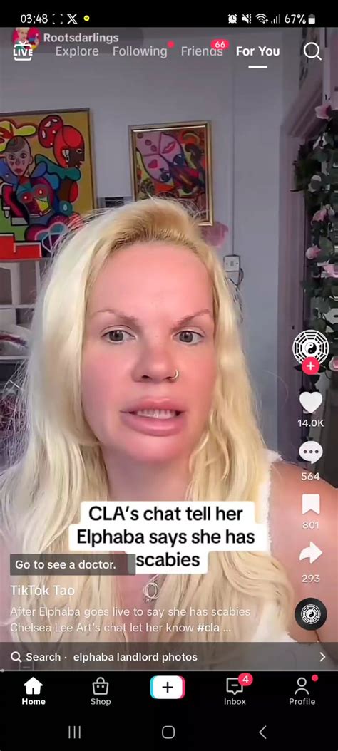 Finds Out She Could Now Have Scabies Relphaoriondoherty