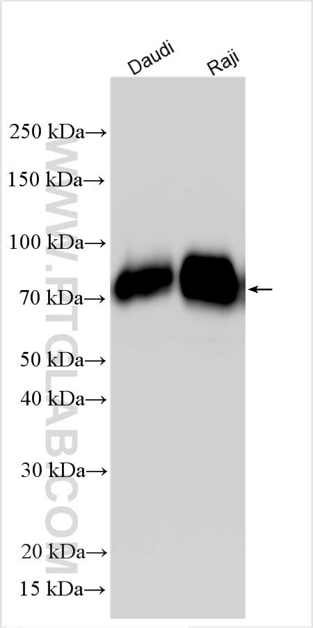 Cd86 Antibody 31449 1 Ap Proteintech
