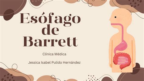 EsÓfago De Barrett Jessica Isabel Pulido Hernandez Udocz
