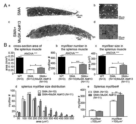 Activation Of Muscle Specific Kinase Musk Reduces Neuromuscular