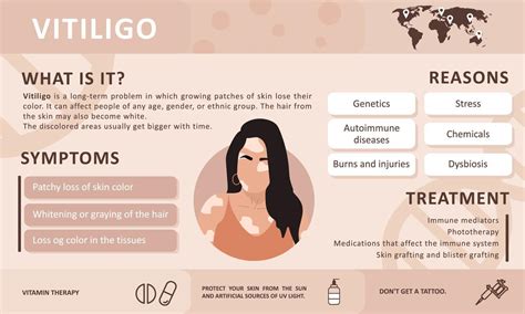 Infographics Of Vitiligo Causes Of The Disease Abstract Woman