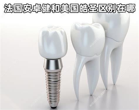 法国安卓健和美国皓圣区别在哪 同一档次材质 价格更好的是 口腔资讯 牙齿矫正网