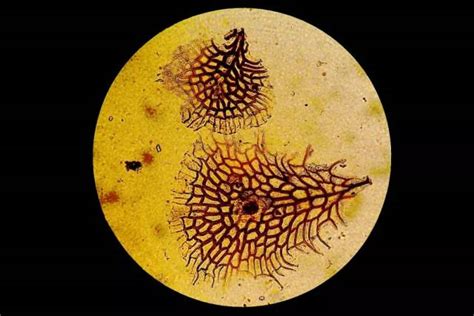 蕨类植物显微镜观察 蕨类植物实验 蕨类植物有哪些 第5页 大山谷图库