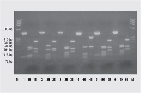Pcr Restriction Enzyme Pattern Analysis Of Mycobacteria Isolated From Download Scientific