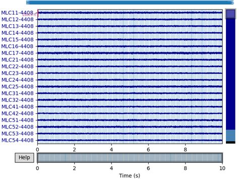 Brainstorm Ctf Phantom Dataset Tutorial — Mne 0 23 4 Documentation