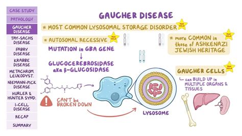 Pathology Outlines Gaucher Disease