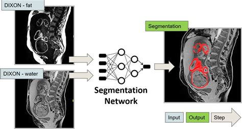 Automatic Fetal Fat Quantification From Mri Deepai