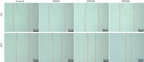 Two Dimensional Migration Assay Of Mscs On The Four Groups Of