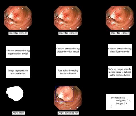 A Comparison Of The Three Common Approaches To Building Colorectal Download Scientific Diagram
