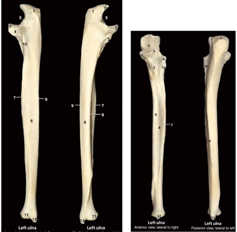 Ulna Diagram Quizlet