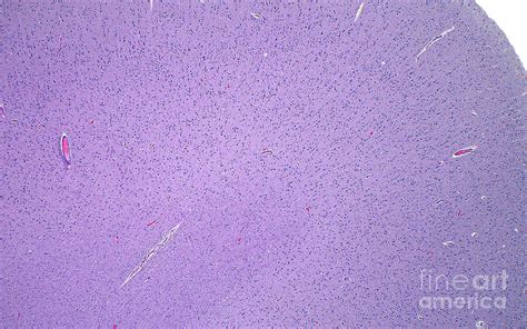 Temporal Cortex By Ziad M El Zaatariscience Photo Library