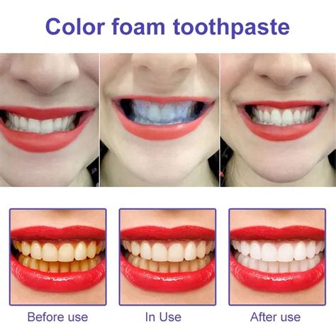 V34 Yellow Teeth Whitening Toothpaste