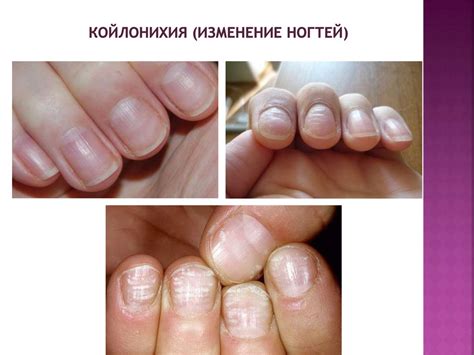 Внешние проявления различных патологических состояний презентация онлайн