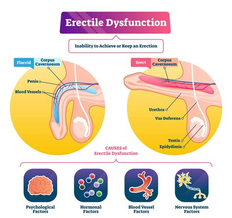 7 Natural Foods To Cure Erectile Dysfunction