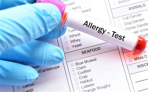 Yeast Allergy Here Are The Foods You Need To Avoid