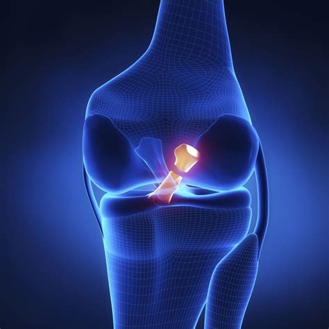 Exercises For A Torn Knee Ligament