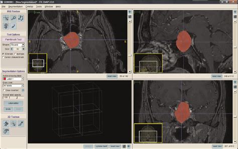 The Figure Shows Four Views Three Orthogonal Views Of A Volumetric Download Scientific Diagram