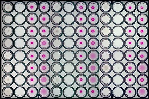 多个圆的检测和圆计算面积方法，实物图如下所示 Csdn社区