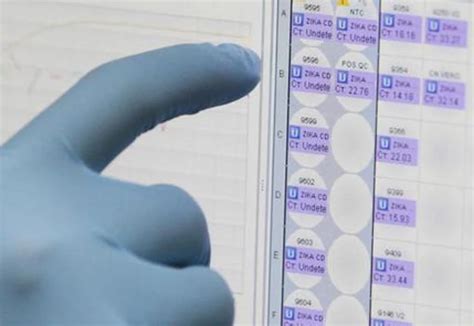 Urine Test Could Simplify Zika Virus Detection