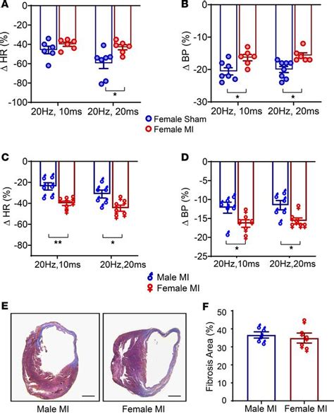 Jci Insight Myocardial Infarction Causes Sex Dependent Dysfunction In