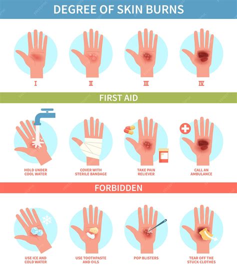 First Aid Pictures For Burns