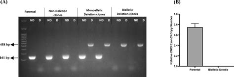 Representative Gel Identifying Non Deletion Monoallelic And Biallelic