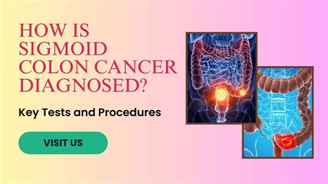 How Is Sigmoid Colon Cancer Diagnosed Key Tests And Procedures