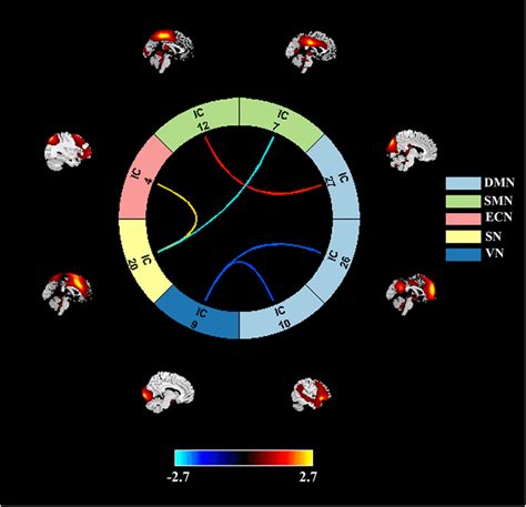 Significant Differences In The Network Connectivity In The Default Mode Download Scientific