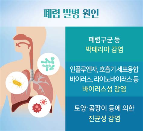 감기로 착각하면 안 되는 치명적인 질환