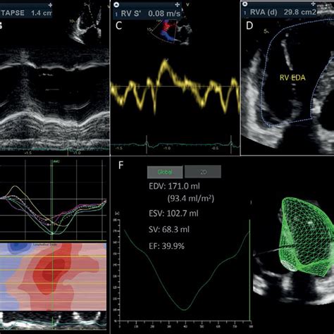 Echocardiographic Assessment Of The Rv Systolic Function In An Adult Download Scientific