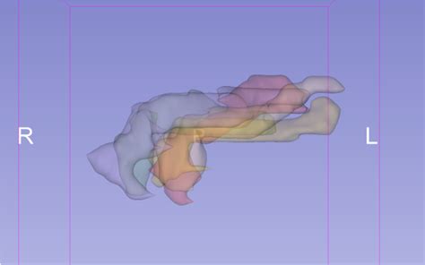 create heatmap in slicer support 3d slicer community
