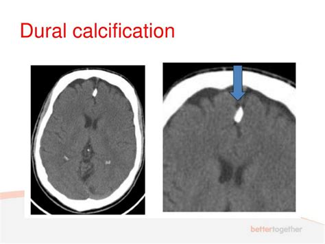Ppt Ct For Adis Module Powerpoint Presentation Free Download Id 4764945