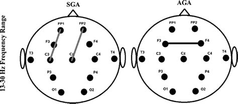 Illustration Of The Electroencephalography EEG Coherence Measures In Download Scientific