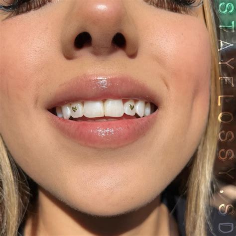 Alerta Tendência Os Piercings No Dente Estão Com Tudo Você Usaria